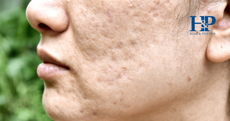 Agent Orange Lung Cancer: Getting VA Benefits for Respiratory Cancers ...