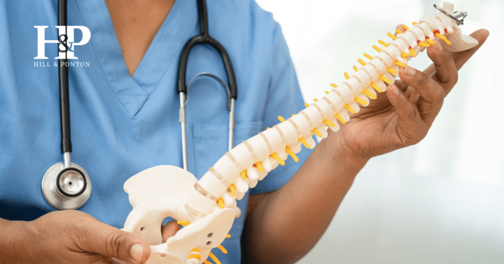 VA Disability Ratings for Spinal Stenosis | Hill & Ponton, P.A.