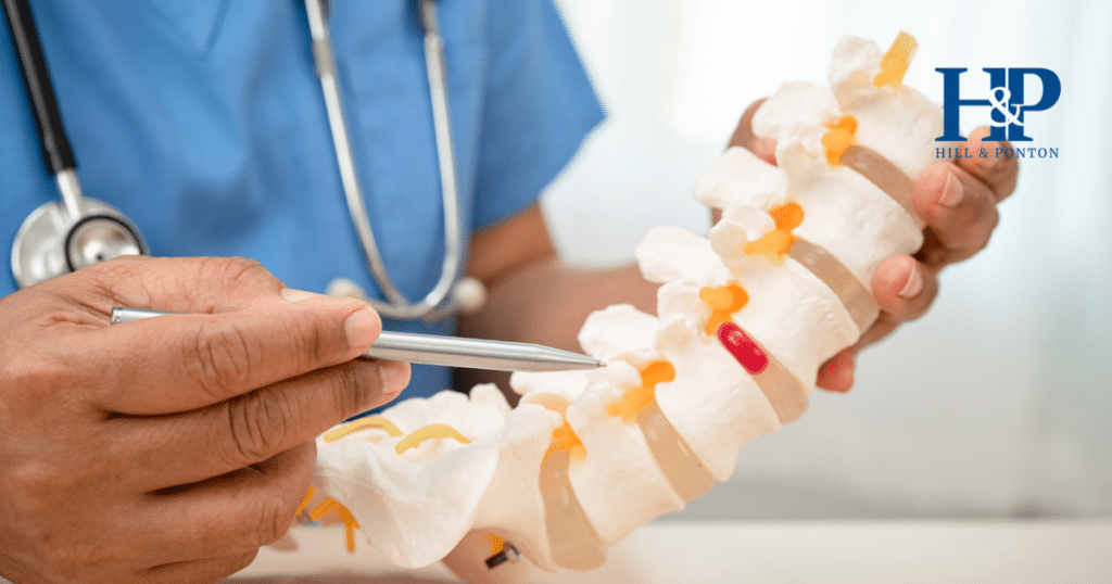 VA Rating for Degenerative Disc Disease | Hill & Ponton, P.A.