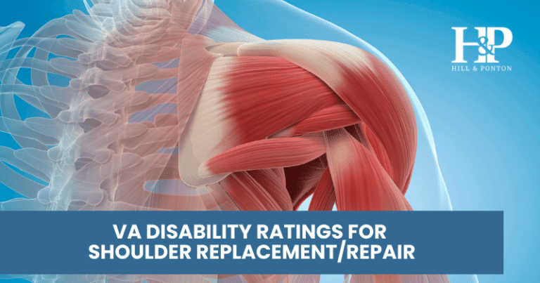 VA Disability Ratings for Shoulder Replacement/Repair: What Veterans ...