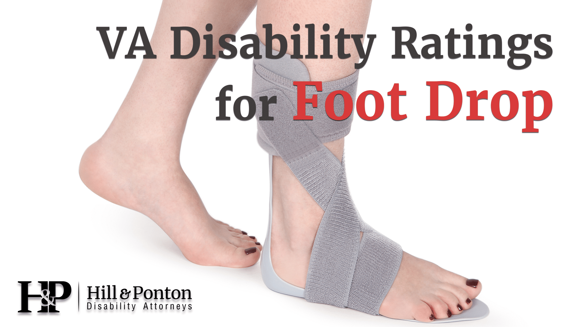 VA Disability Rating for Foot Drop | Hill & Ponton, P.A.