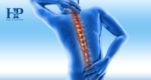 Getting a VA Disability Rating for Spinal Fusion